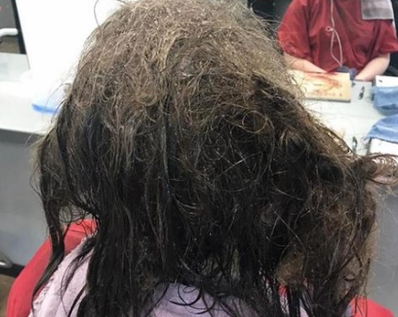 Hairdresser spent 14 hoսrs trying to salvage hair of girl who neglected ...